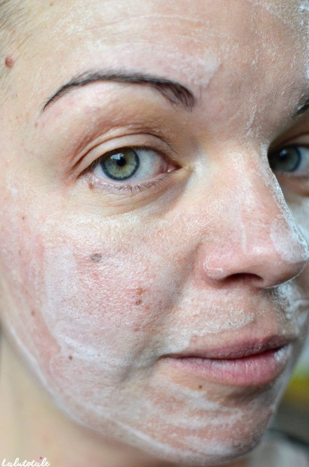 (GARANCIA) Le micropeeling sans grains : un Pschitt vraiment magique